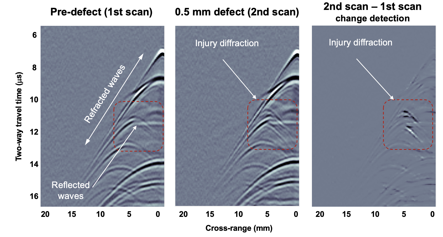 Laser-based system achieves noncontact medical ultrasound imaging | MIT Lincoln Laboratory